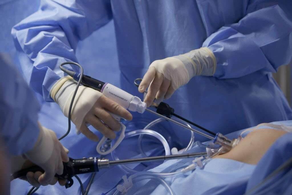 Λαπαροσκοπική Χειρουργική - Dr. Δημήτριος Κανέλλος Χειρουργός Θεσσαλονίκη