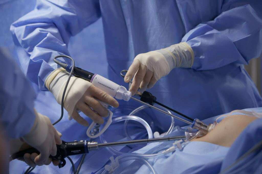 Λαπαροσκοπική Χειρουργική - Dr. Δημήτριος Κανέλλος Χειρουργός Θεσσαλονίκη